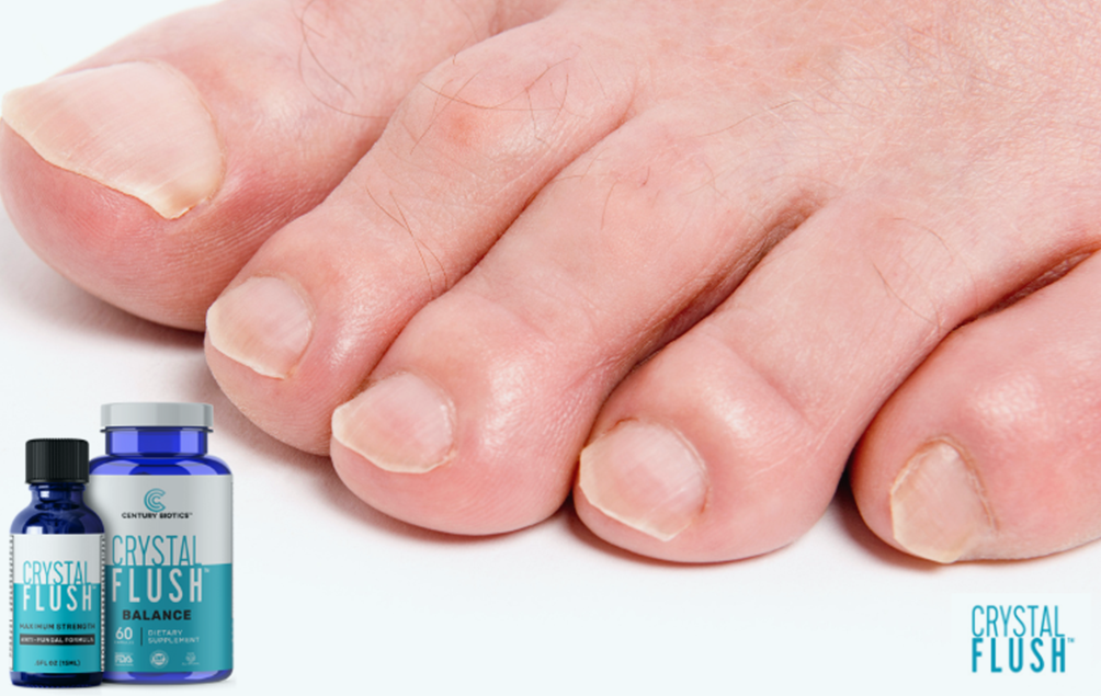 Why You Should Treat Toenail Fungus in the Winter? Crystal Flush Antif